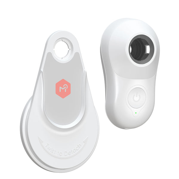 TrikoScope – MetaOptima Technology