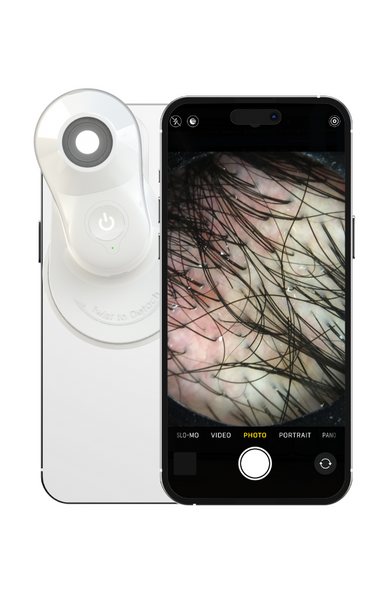 TrikoScope – MetaOptima Technology